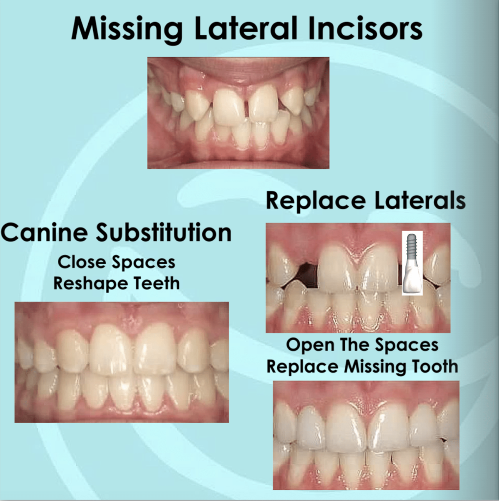 Cosmetic Dental Procedures Before and Afters | Wow Smiles