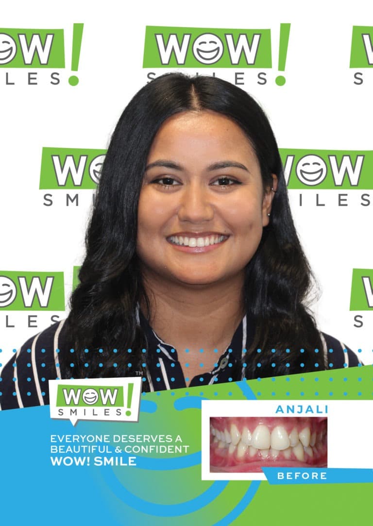Orthodontic Before & Afters | Braces | Invisalign | Wow Smiles
