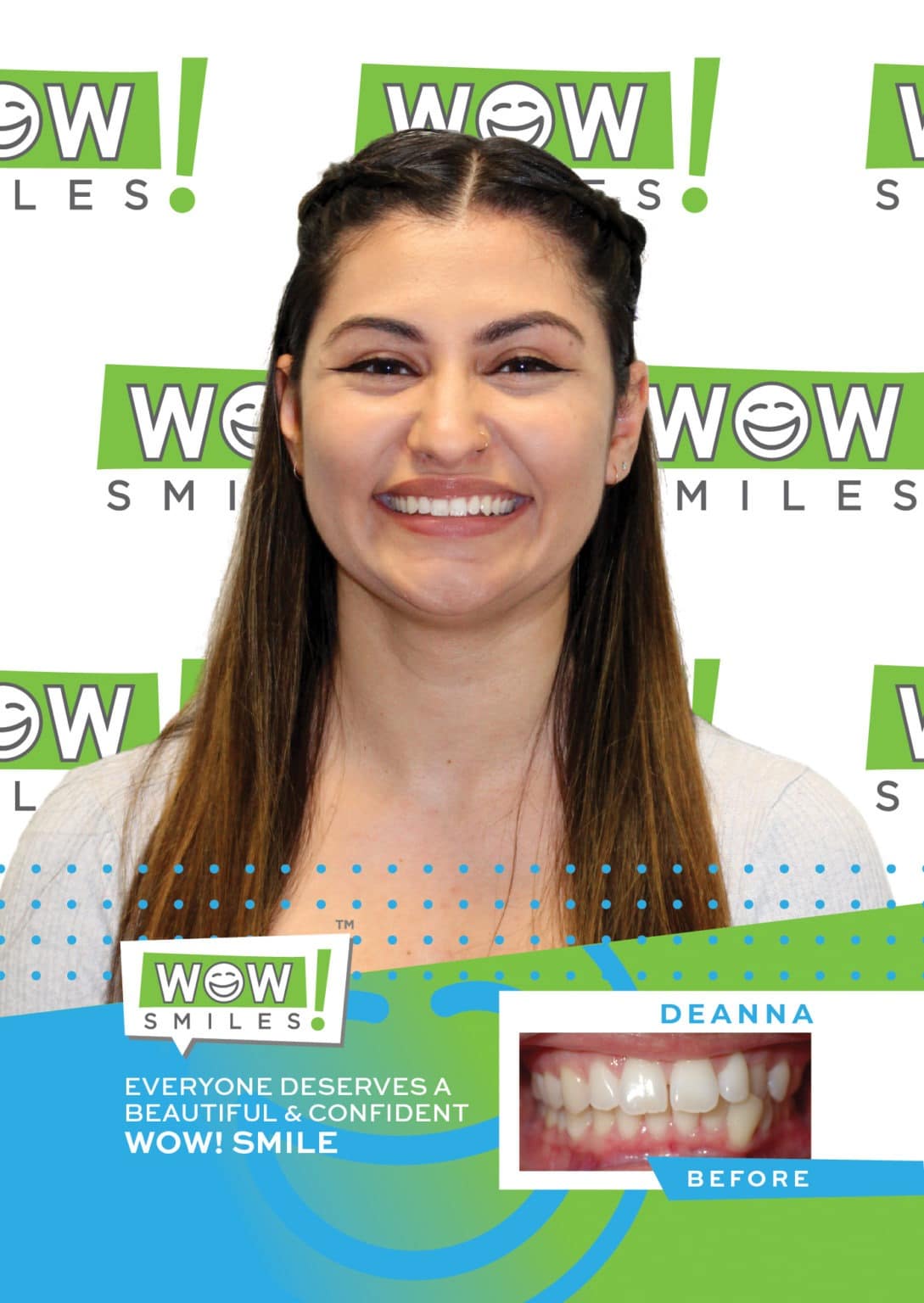 Orthodontic Before & Afters | Braces | Invisalign | Wow Smiles