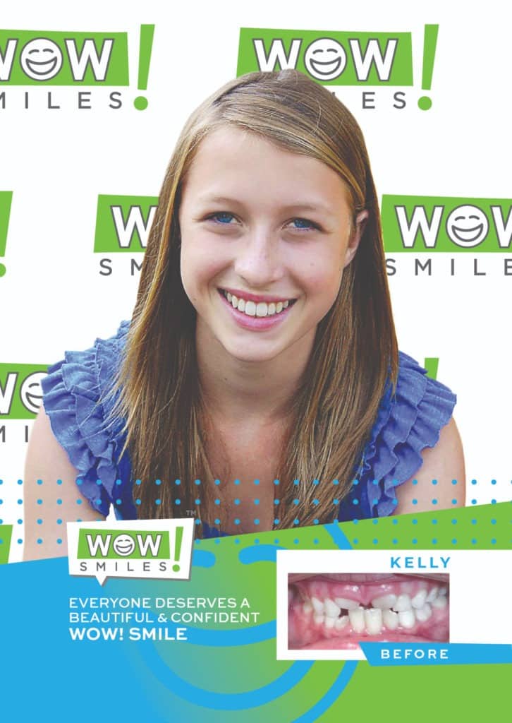 Orthodontic Before & Afters | Braces | Invisalign | Wow Smiles