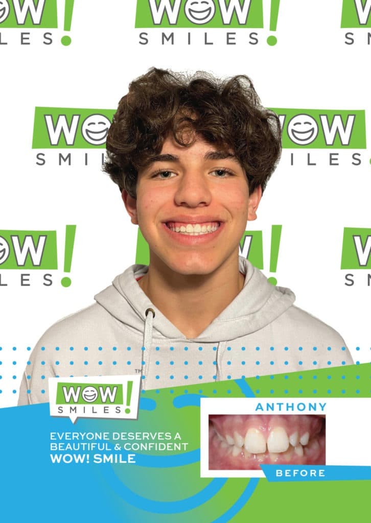 Orthodontic Before & Afters | Braces | Invisalign | Wow Smiles