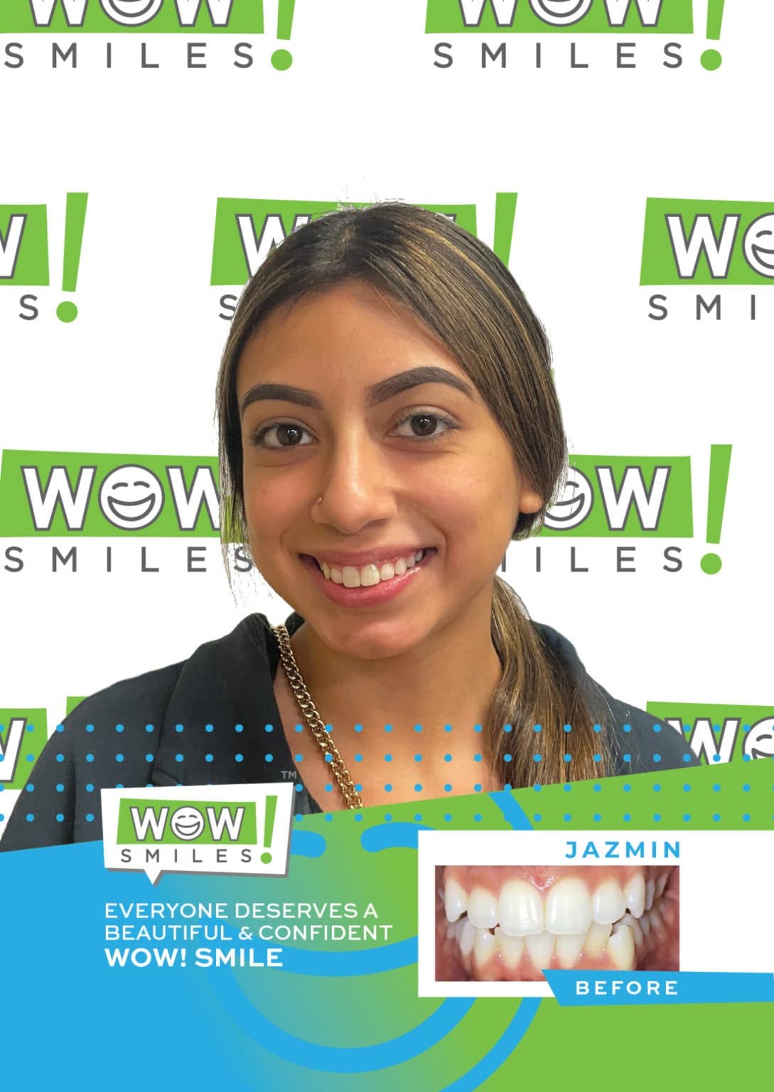 Orthodontic Before & Afters | Braces | Invisalign | Wow Smiles