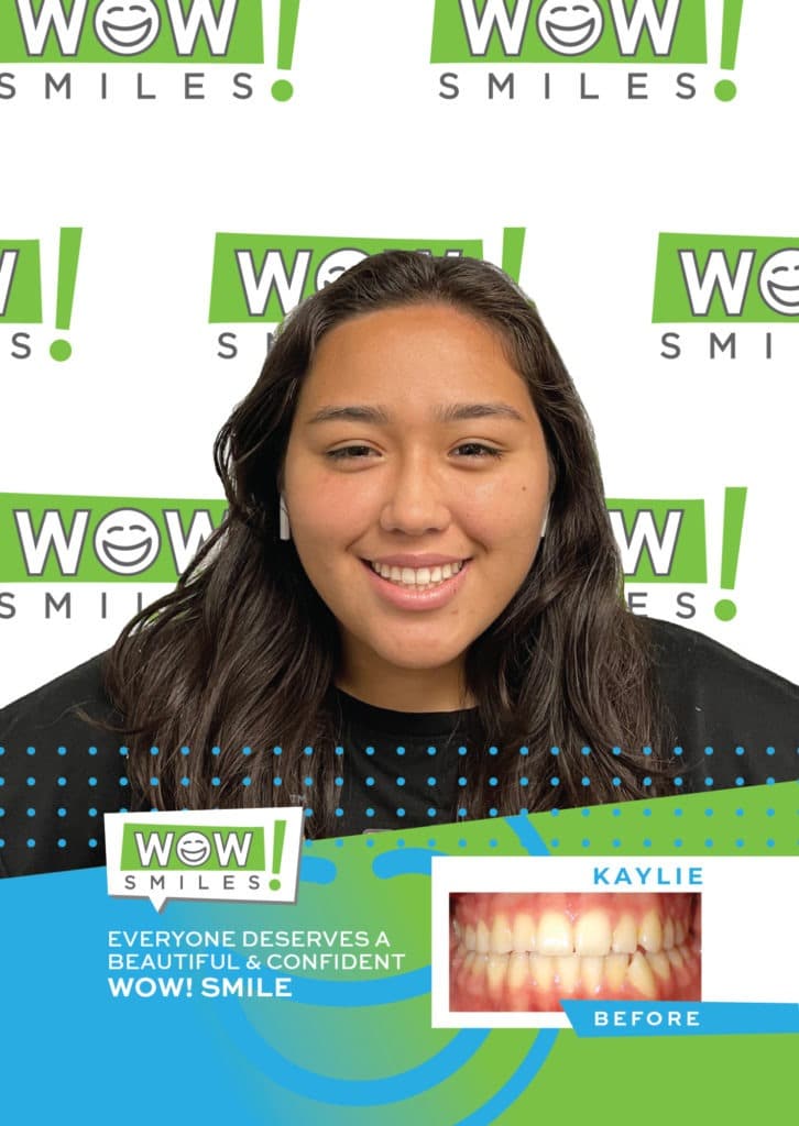 Orthodontic Before & Afters | Braces | Invisalign | Wow Smiles